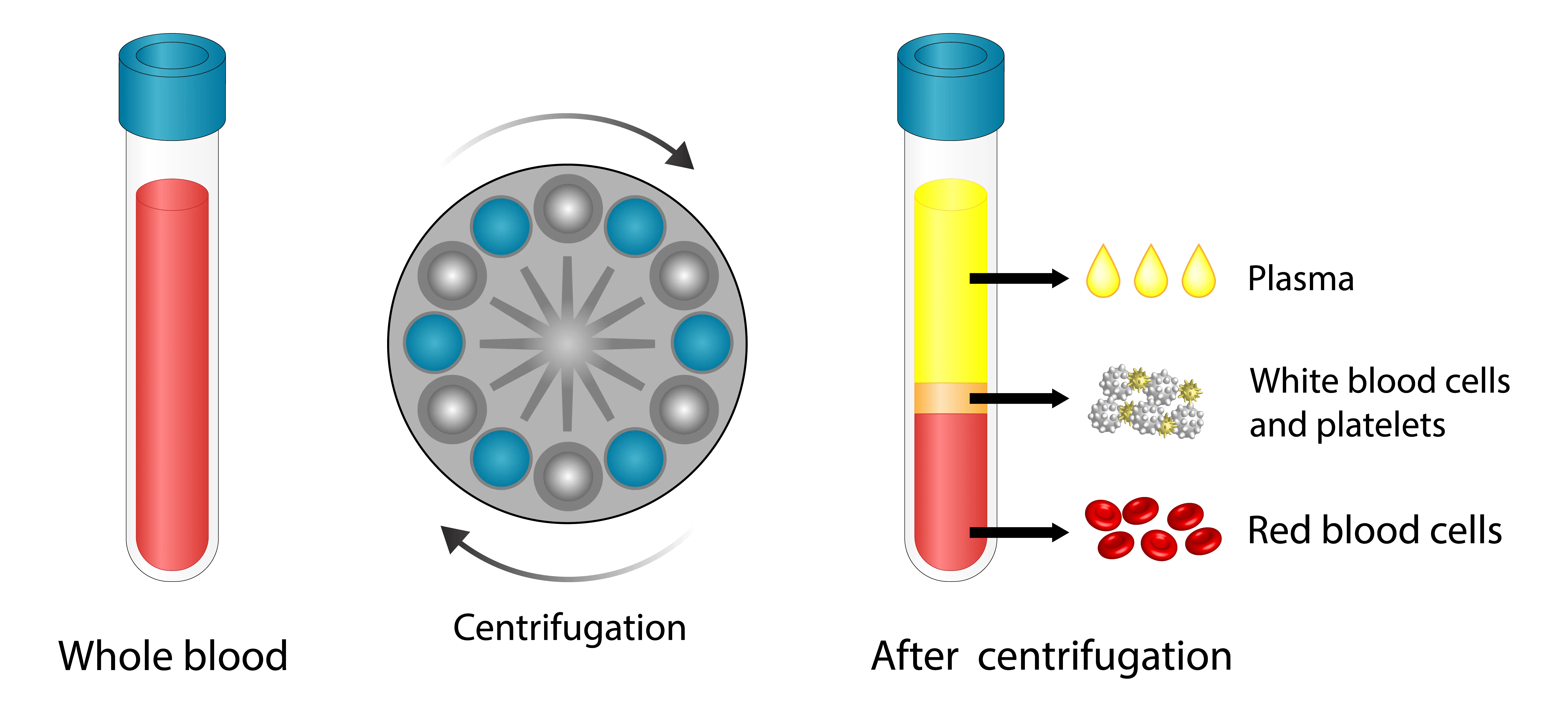 What Is a PRP Injection? - Paul Kiritsis, MD - Richmond, VA Premier ...